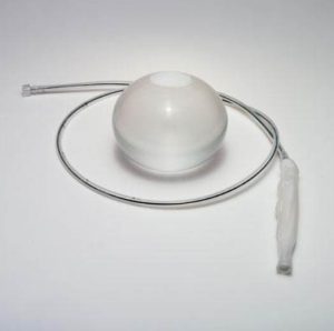 12-Month Gastric Balloon in Málaga | Experts with Years of Experience