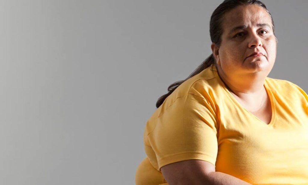 Qué es la obesidad mórbida y cómo se trata
